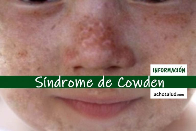 Síndrome de Cowden: síntomas y opciones de tratamiento